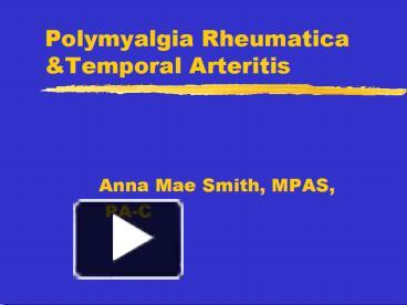 Polymyalgia Rheumatica presentation | free to view