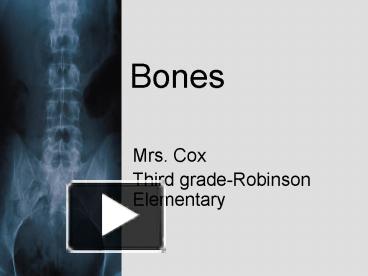 PPT – Bones PowerPoint presentation | free to view - id: 20d37f-YTcwZ