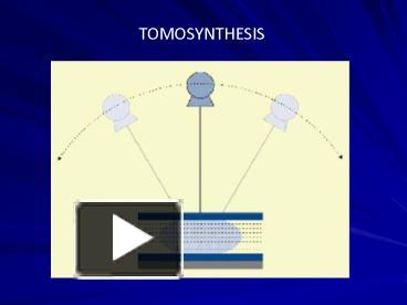 TOMOSYNTHESIS presentation | free to view