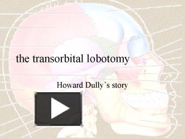 the transorbital lobotomy presentation | free to view