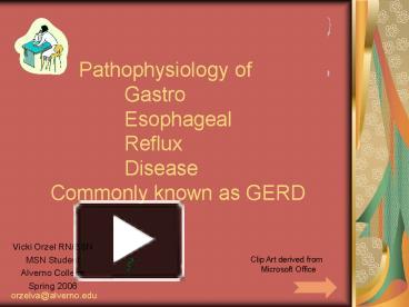 Pathophysiology of Gastro Esophageal Reflux Disease Commonly known as ...