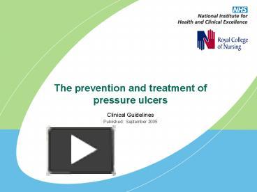 The prevention and treatment of pressure ulcers presentation | free to view