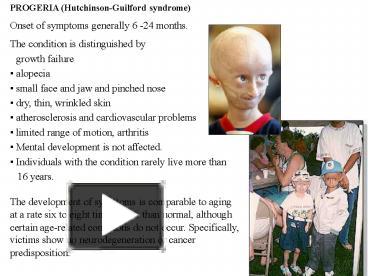 PROGERIA (Hutchinson-Guilford syndrome) presentation | free to view