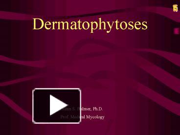PPT – Dermatophytoses PowerPoint presentation | free to view - id ...