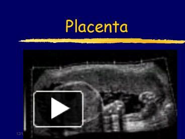 Placenta presentation | free to view