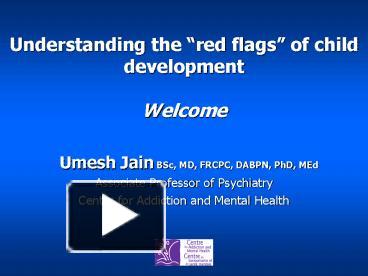 Understanding the red flags of child development Welcome presentation ...