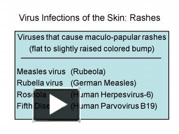 Virus Infections of the Skin: Rashes presentation | free to view