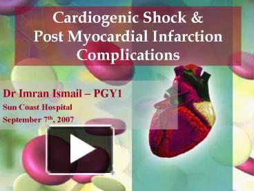 Cardiogenic Shock presentation | free to view