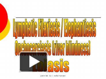 Lymphatic Filariasis Elephantiasis presentation | free to view