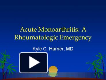 Acute Monoarthritis: A Rheumatologic Emergency presentation | free to view
