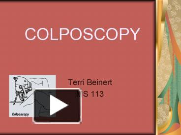 COLPOSCOPY presentation | free to view