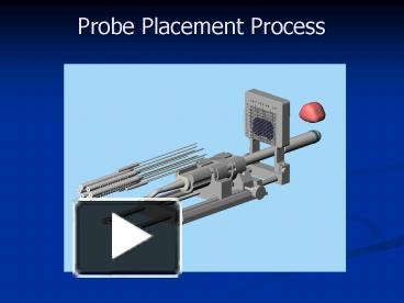 PPT – Probe Placement Process PowerPoint presentation | free to view ...