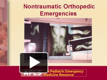 Nontraumatic Orthopedic Emergencies presentation | free to view