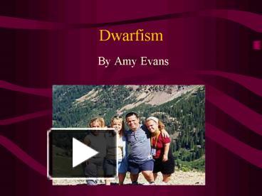 Dwarfism presentation | free to view