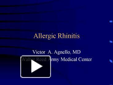PPT – Allergic Rhinitis PowerPoint presentation | free to view - id ...