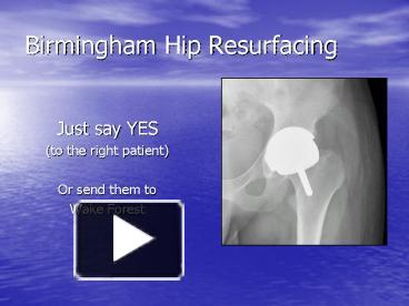 Birmingham Hip Resurfacing presentation | free to view