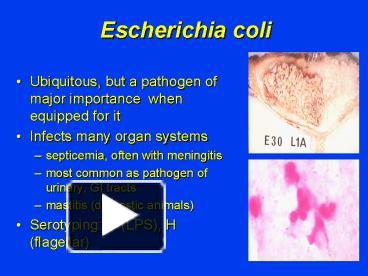 Escherichia coli presentation | free to view