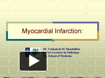 PPT – Myocardial Infarction: PowerPoint presentation | free to view ...