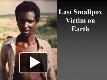PPT – Last Smallpox Victim on Earth PowerPoint presentation | free to ...