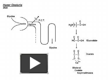 Hyper Oxaluria presentation | free to download