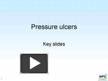 PPT – Pressure ulcers PowerPoint presentation | free to view - id ...