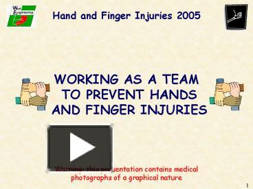 Hand and Finger Injuries 2005 presentation | free to view