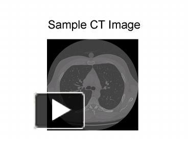 PPT – Sample CT Image PowerPoint presentation | free to view - id ...