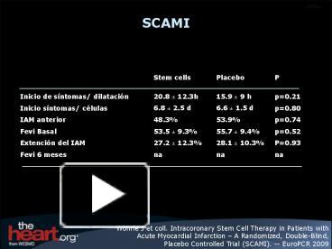 PPT – SCAMI PowerPoint presentation | free to view - id: 27a3c9-MGFlM