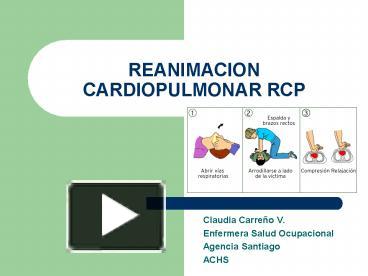 REANIMACION CARDIOPULMONAR RCP presentation | free to view