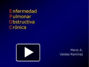 PPT – E P OC PowerPoint presentation | free to download - id: 27e128-OWU1M