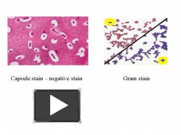 PPT – Capsule stain PowerPoint presentation | free to view - id: 28128 ...