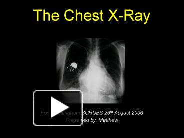 The Chest XRay presentation | free to view