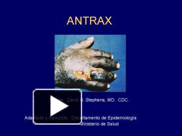 ANTRAX presentation | free to view