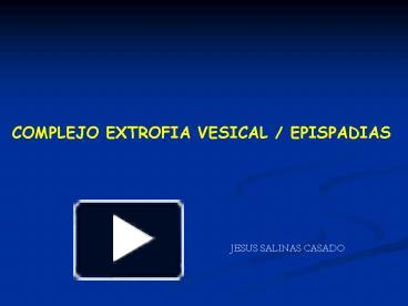 COMPLEJO EXTROFIA VESICAL EPISPADIAS presentation | free to view