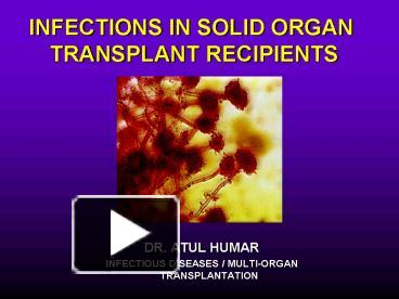 PPT – DR' ATUL HUMAR PowerPoint presentation | free to view - id ...