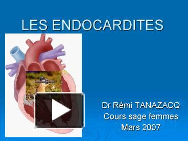 LES ENDOCARDITES presentation | free to view