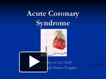 Acute Coronary Syndrome presentation | free to view