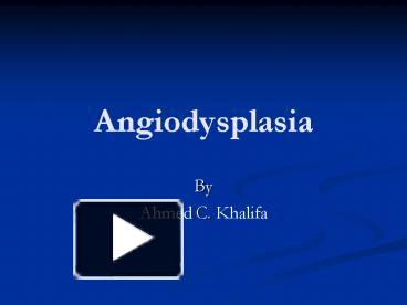 Angiodysplasia presentation | free to view