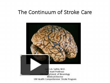 The Continuum of Stroke Care presentation | free to view