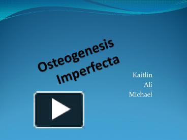 Osteogenesis Imperfecta presentation | free to view