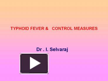 TYPHOID FEVER presentation | free to download