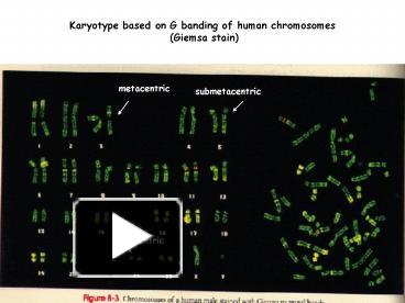 PPT – Karyotype based on G banding of human chromosomes PowerPoint ...