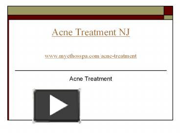 Acne Treatment presentation | free to view