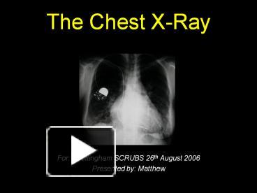 The Chest X-Ray presentation | free to view