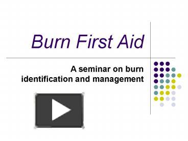 Burn First Aid presentation | free to download