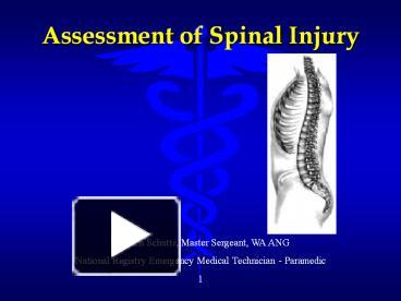PPT – Assessment of Spinal Injury PowerPoint presentation | free to ...