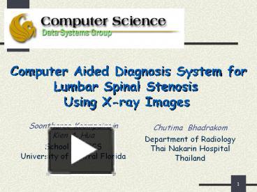 Computer Aided Diagnosis System for presentation | free to view
