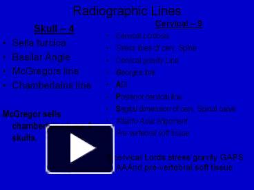 PPT – Radiographic Lines PowerPoint presentation | free to download ...