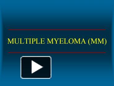 MULTIPLE MYELOMA (MM) presentation | free to download