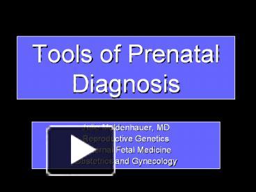 PPT – Tools of Prenatal Diagnosis PowerPoint presentation | free to ...